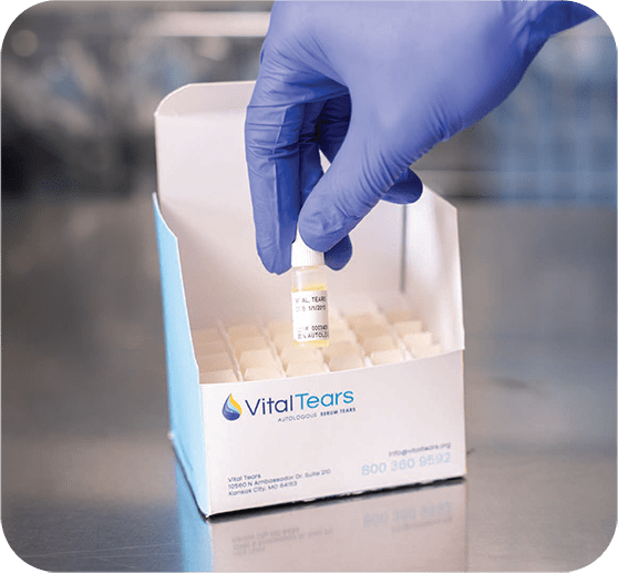 Vital Tears | Leader in Autologous Serum Eye Drops